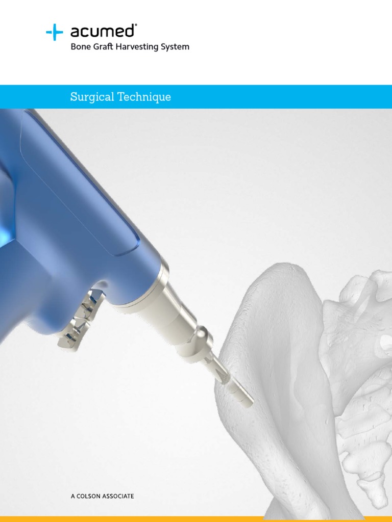 Acumed Surgical Technique EN Bone Graft Harvesting System BIO00 03 C ...