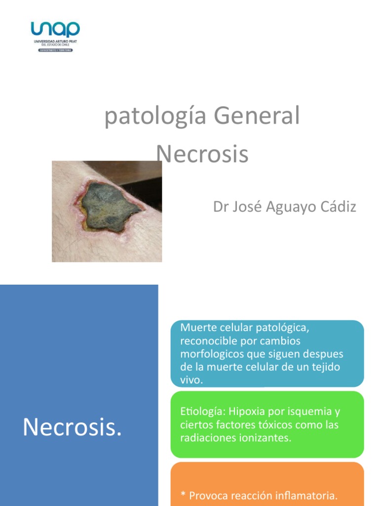 Necrosis+2021dr Aguayo | PDF | Inflamación | Necrosis