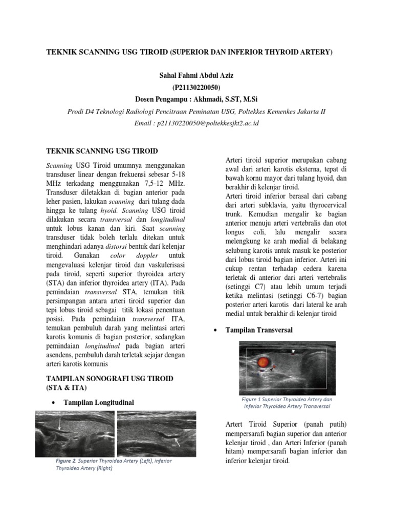 Teknik Scanning Usg Tiroid (Superior Dan Inferior Thyroid Artery) | PDF