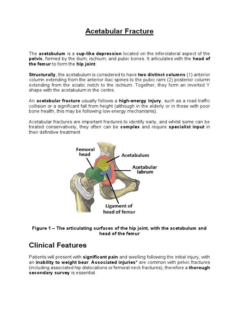 Acetabular Fracture | PDF | Pelvis | Hip