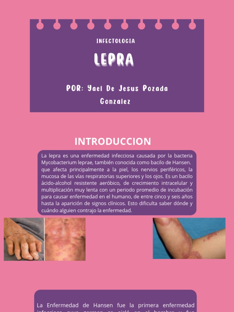 Diapositivas Sobre La Lepra | PDF | Lepra | Tuberculosis