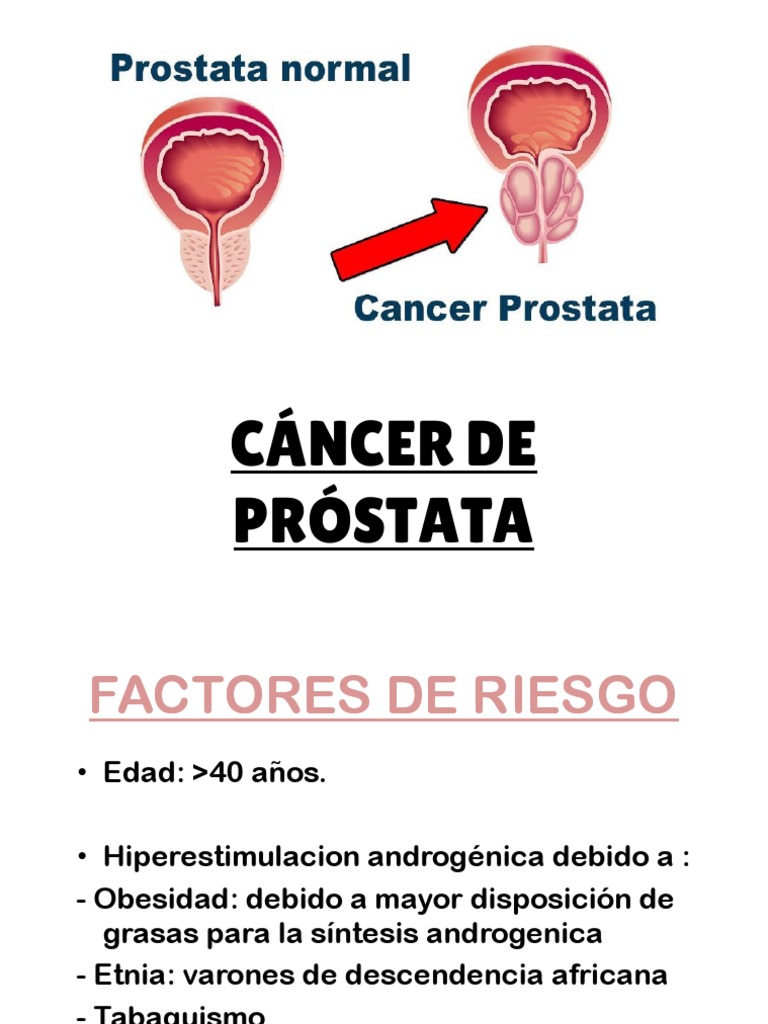 Ca de Prostata - 2022 | PDF