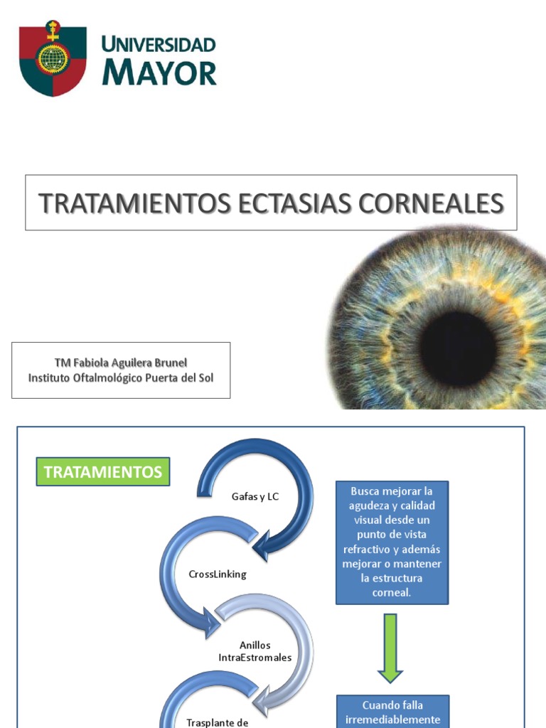 Tratamientos para Ectasias Corneales | PDF