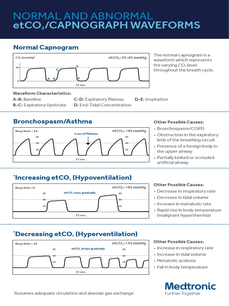 Capnograpy Ems Waveform Reference Card | PDF | Exhalation | Clinical ...