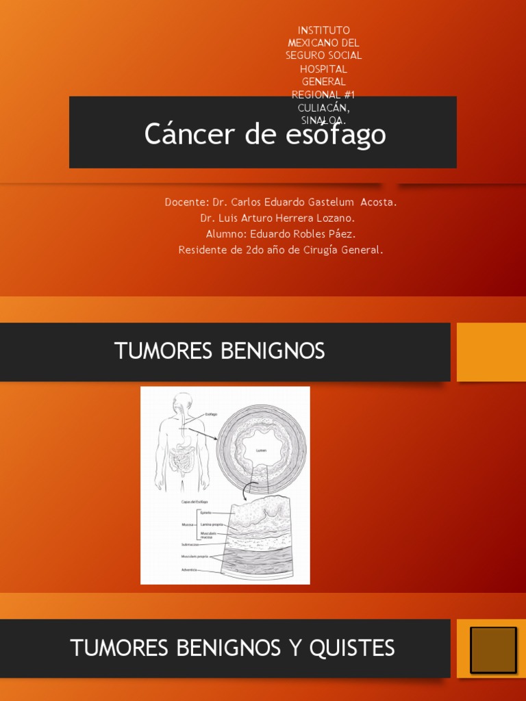 Cancer Esofago Plantilla | PDF | Cáncer de esófago | Cáncer