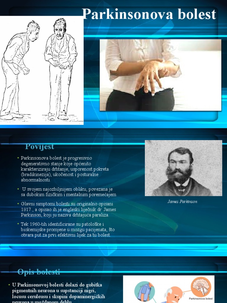 Parkinsonova Bolest | PDF