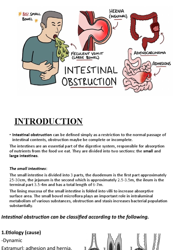 Examination of Intestinal Obstruction, Acute Abdomen and Acute ...