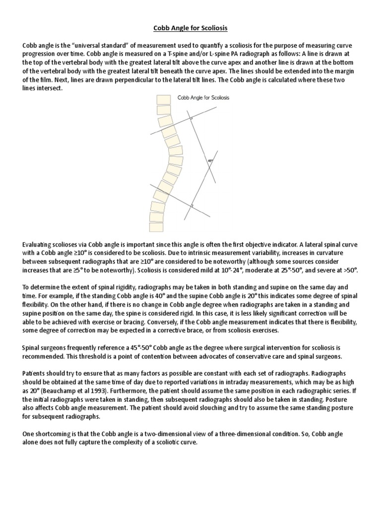 Cobb Angle For Scoliosis | PDF | Scoliosis | Clinical Medicine