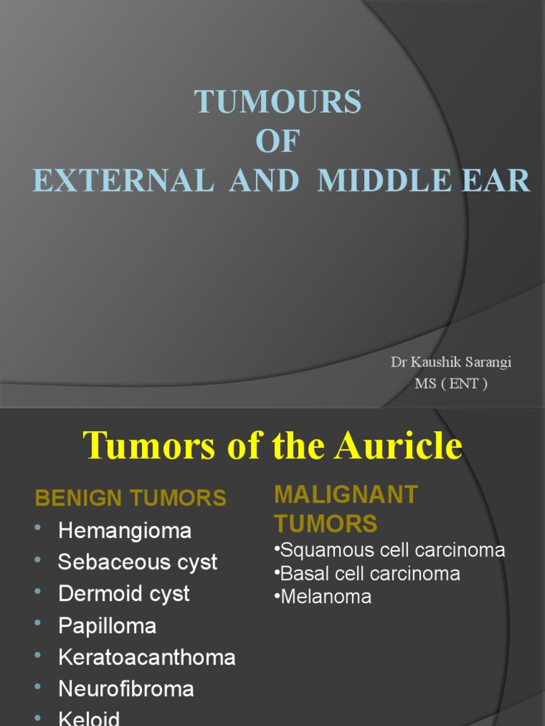 Tumors of External and Middle Ear | PDF | Adenoma | Neoplasms