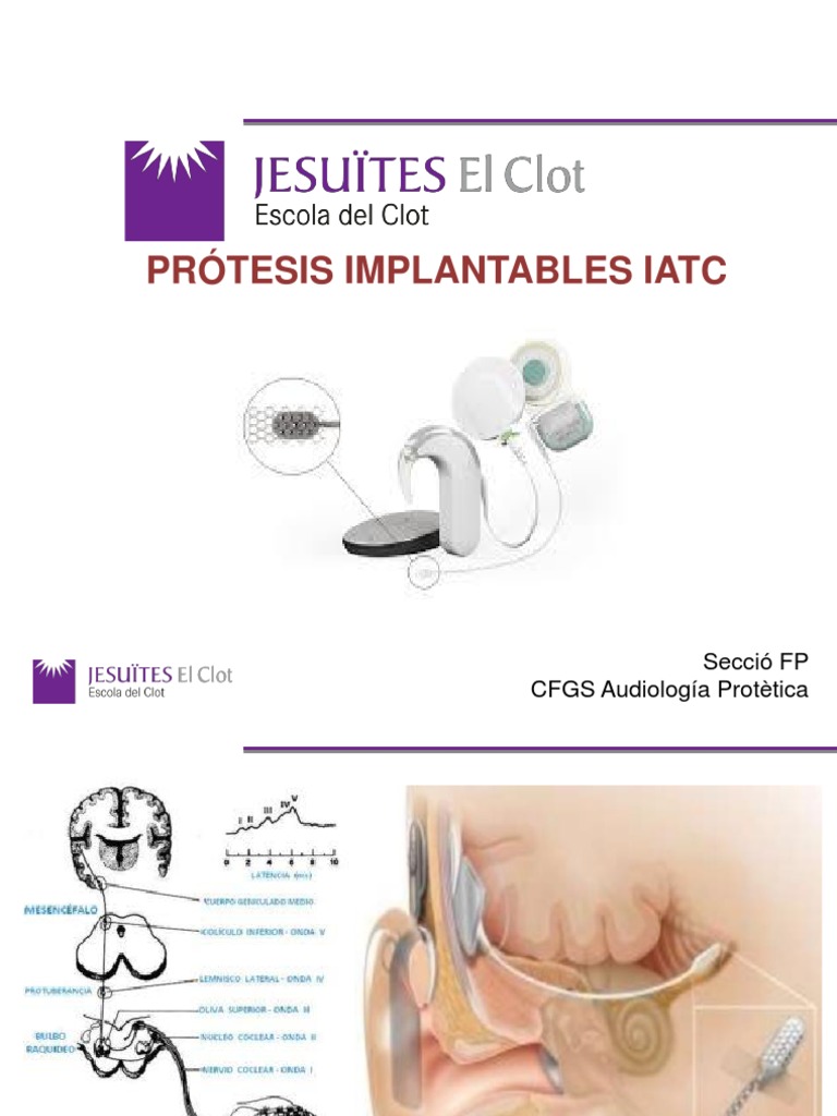Implantables IATC | PDF | Sistema nervioso | Ciencias de la Salud