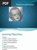 Hydrocephalus Lesson Plan | PDF | Cerebrospinal Fluid | Medical Specialties