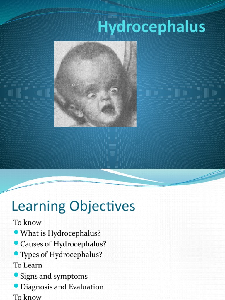 Hydrocephalus | PDF | Cerebrospinal Fluid | Anatomy