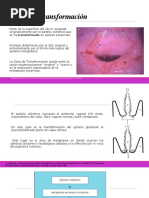 ZONA DE TRANFORMACION EN COLPOSCOPIA - Dra. Isa Ma. de Mello | PDF ...