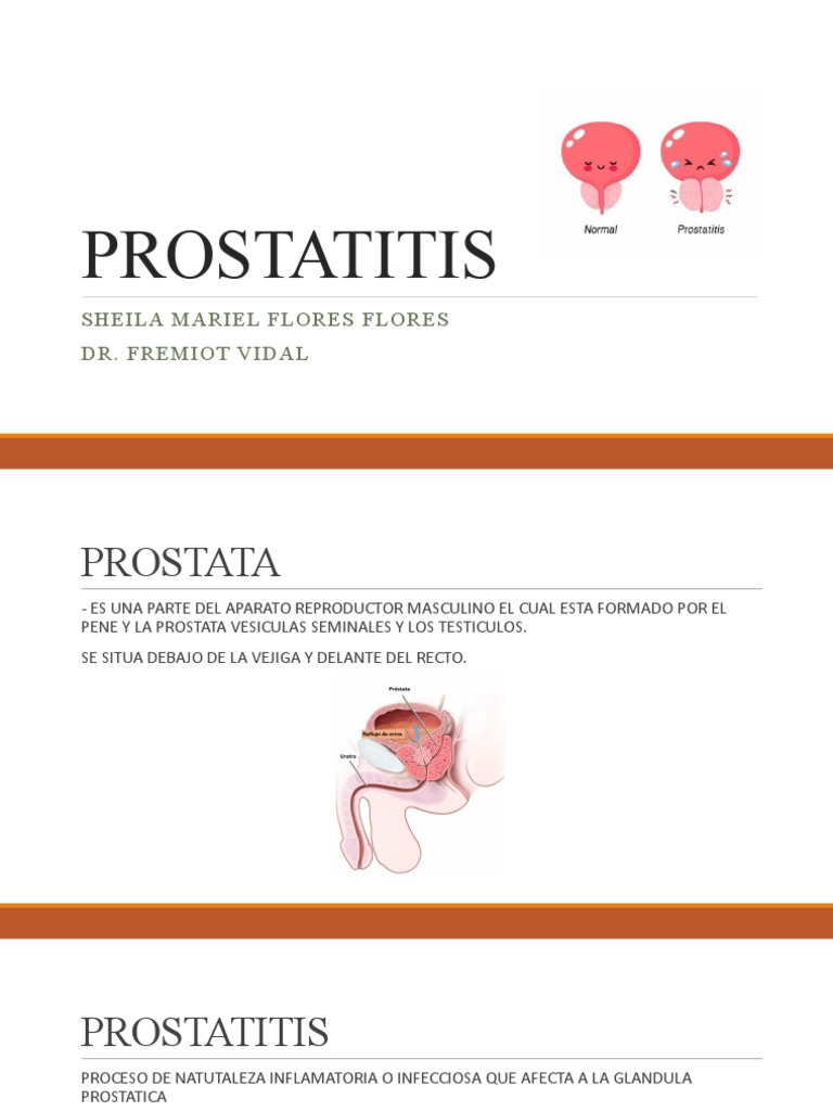 PROSTATITIS | PDF | Próstata | Sistema genitourinario