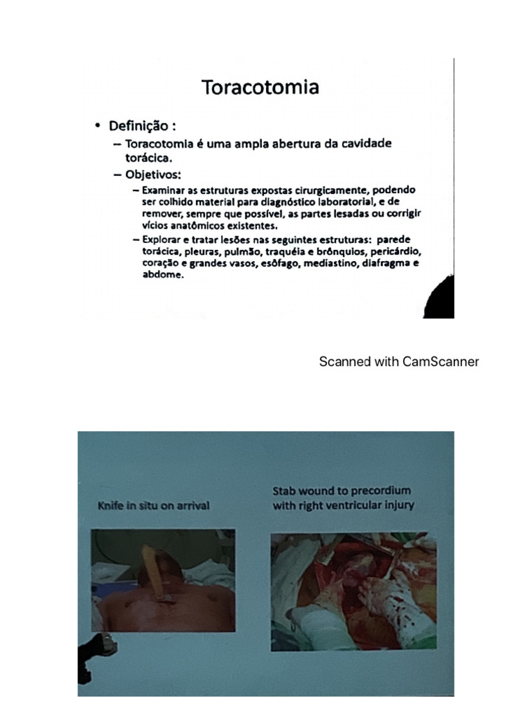 Toracotomia Slides | PDF