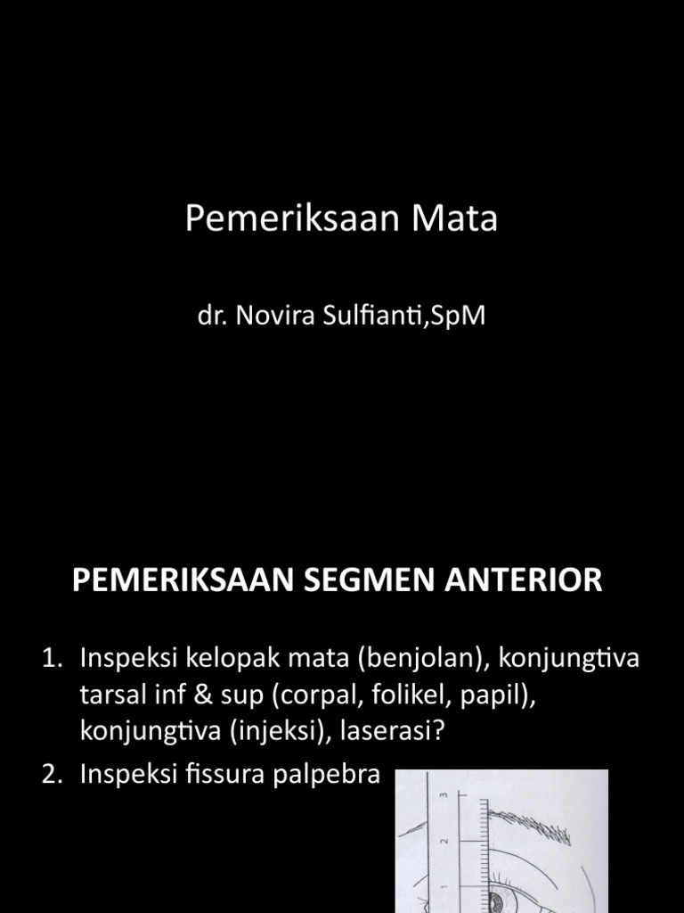 Pemeriksaan Mata | PDF | Kesehatan Holistik