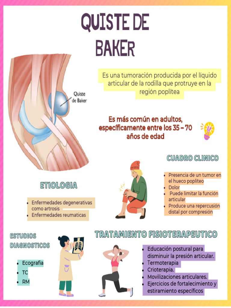 Infografía Quiste de Baker | PDF | Rodilla | Medicina CLINICA