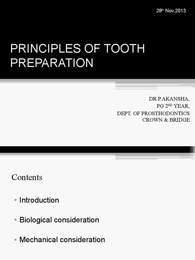 S- Tooth Preparation in Fpd | PDF
