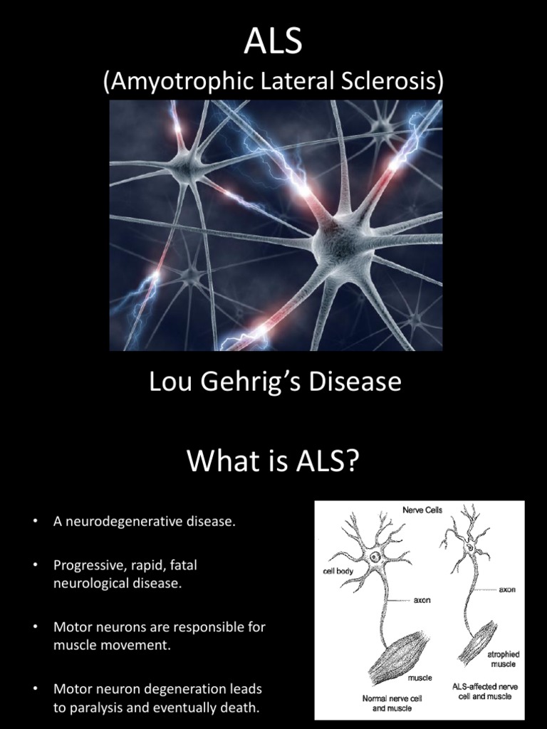 (Amyotrophic Lateral Sclerosis) : Lou Gehrig's Disease | PDF ...