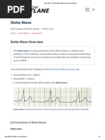 Delta Wave in WPW Syndrome Explained | PDF | Cardiac Electrophysiology ...