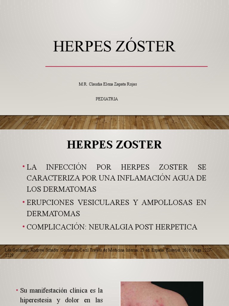 Herpes Zóster: Síntomas y Tratamiento | PDF | Inmunología | Condiciones ...