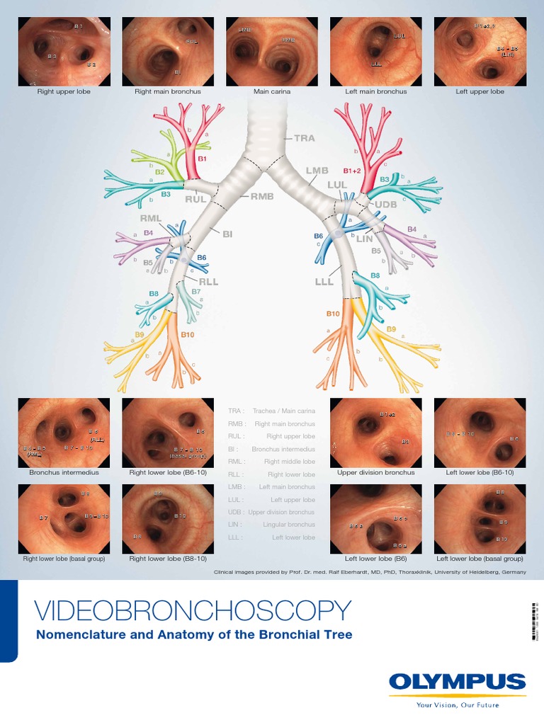 Bronchial Tree Anatomy Overview | PDF | Respiratory System | Thorax ...