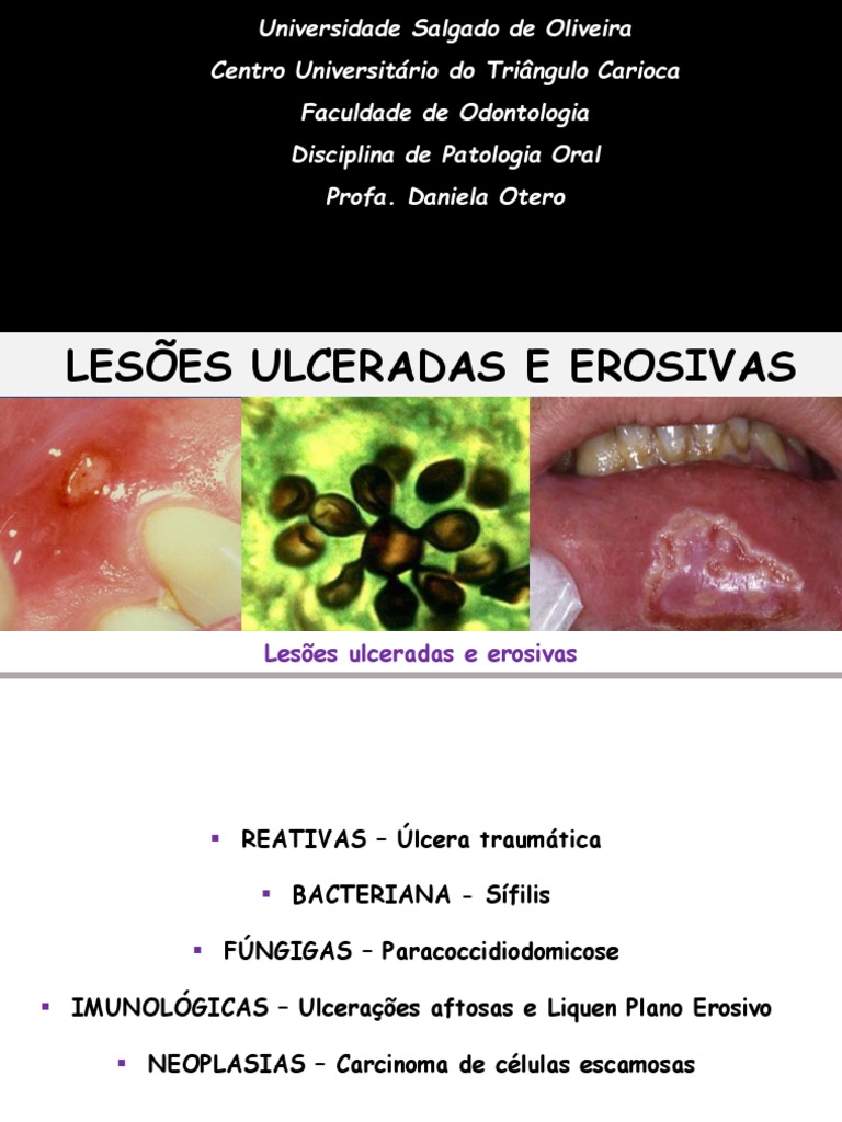 Aula de Lesões Erosivas e Ulceradas | PDF | Anatomia | Especialidades ...