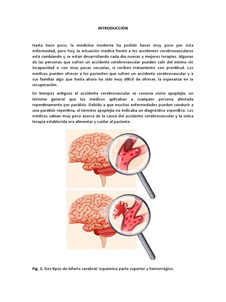 Acv Monografia | PDF