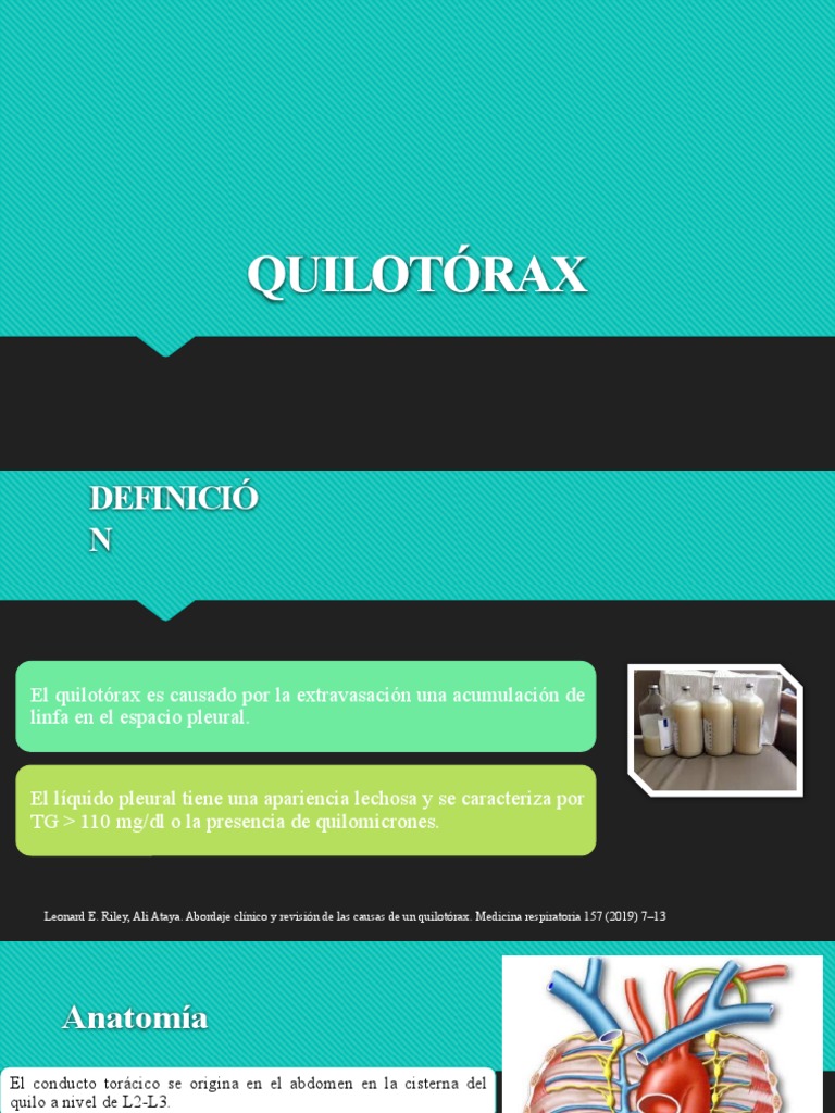 Quilotorax Expo Nueva | PDF | Sistema linfático | Medicina CLINICA