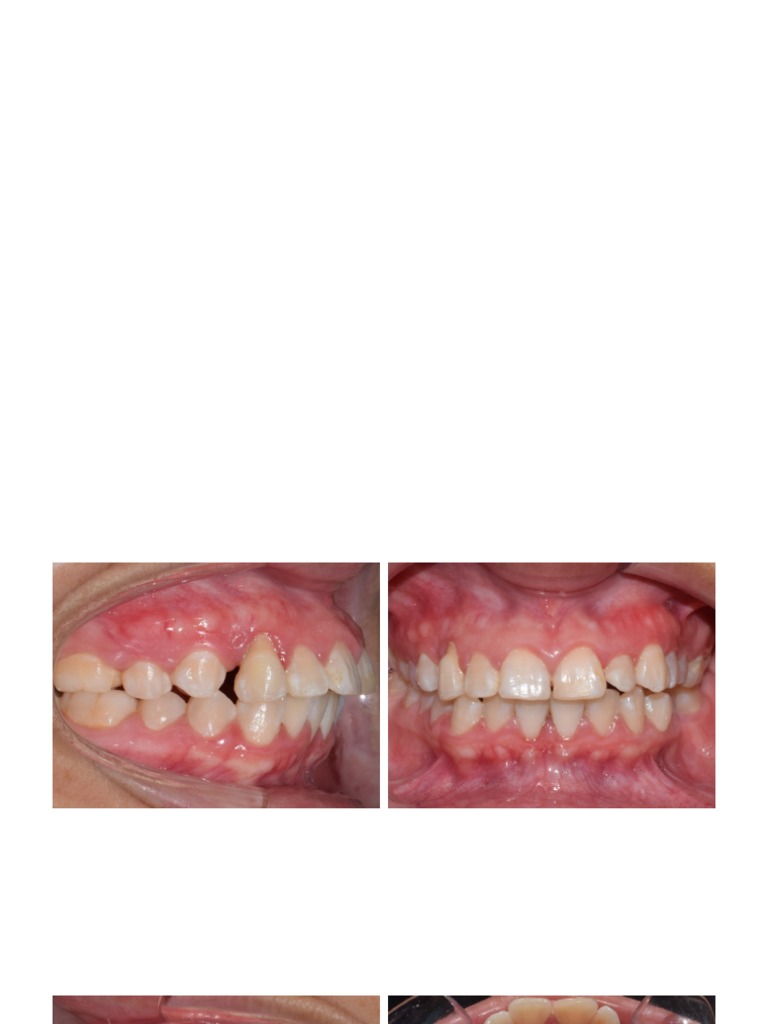 Interconsulta Sofia Cesar Machuca | PDF | Odontología | Implante dental