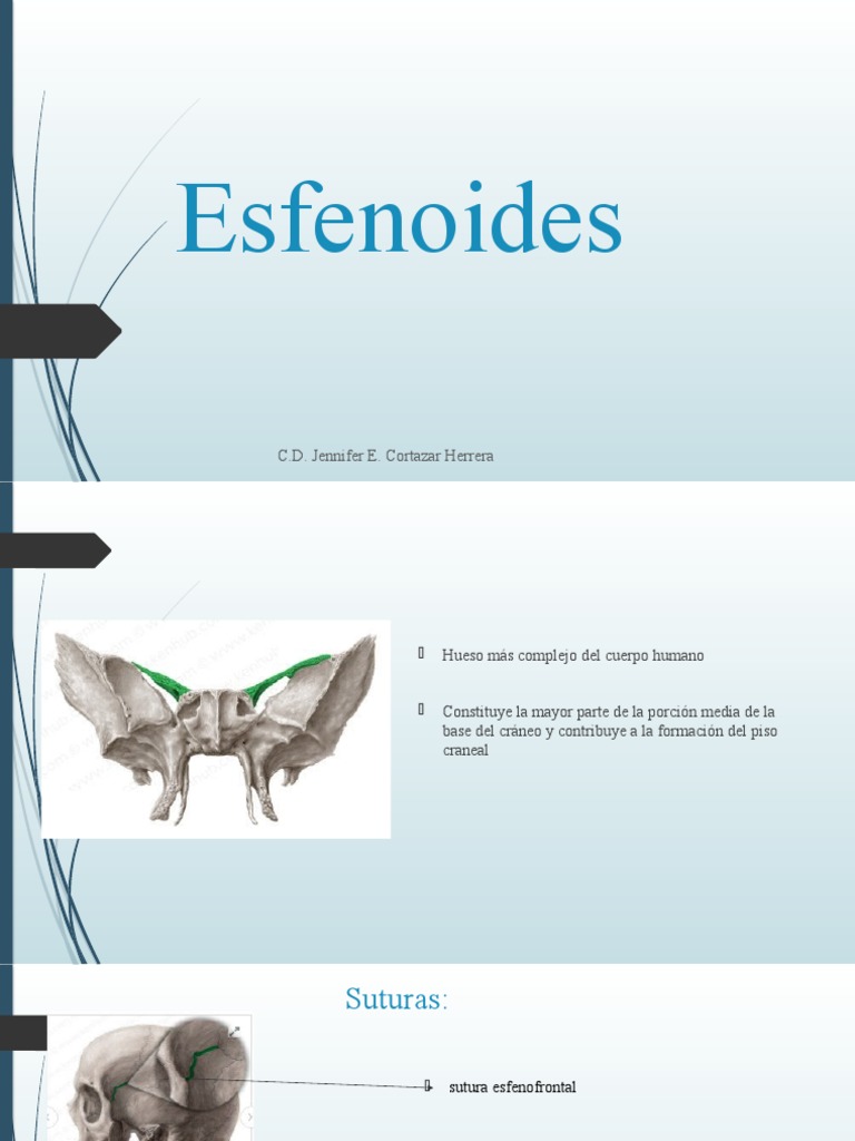Anatomía del Hueso Esfenoides | PDF | Sistema esquelético | Anatomía
