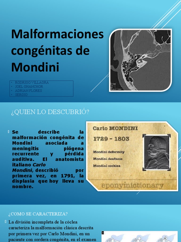 Malformaciones congénitas de Mondini | PDF | Meningitis | Oído