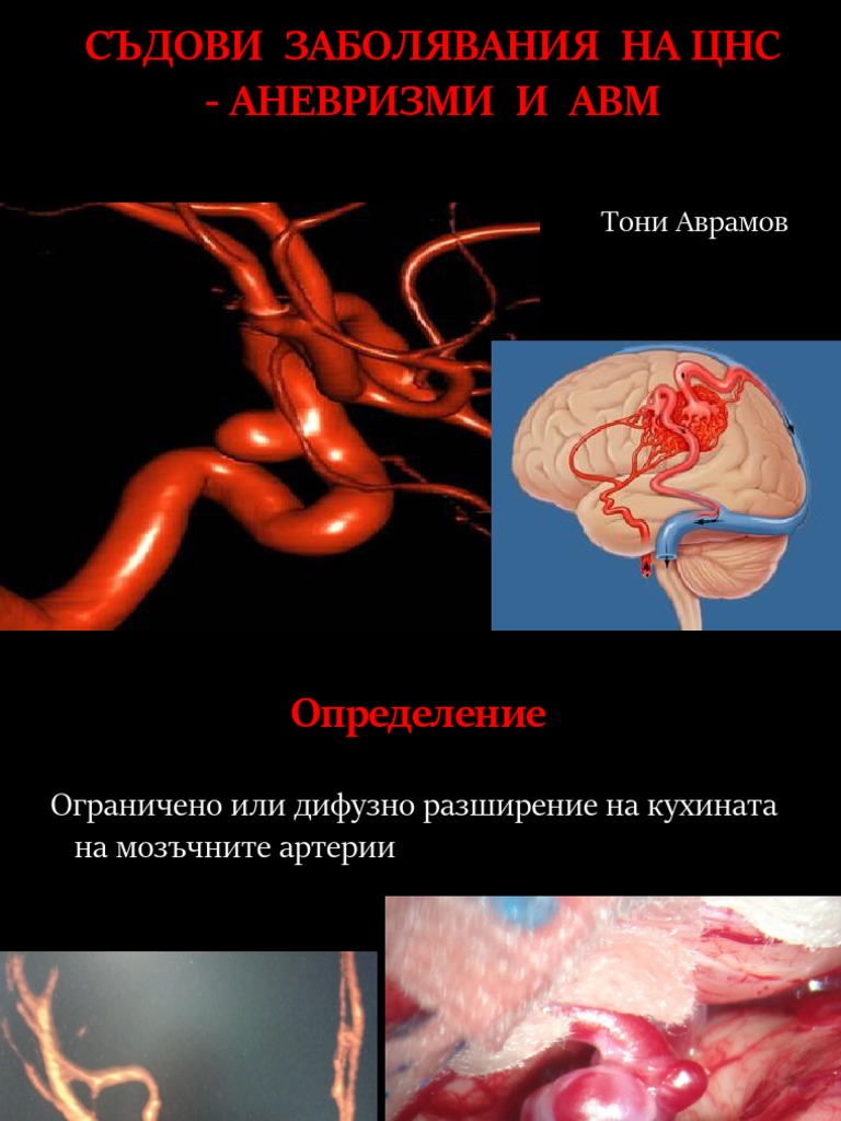 Brain Vascular Diseases Lecture Pdf
