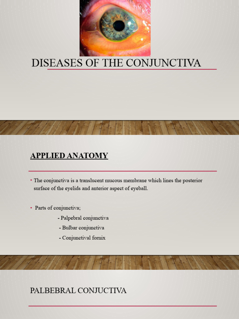 Diseases of The Conjuctiva II | PDF | Diseases And Disorders | Medical ...