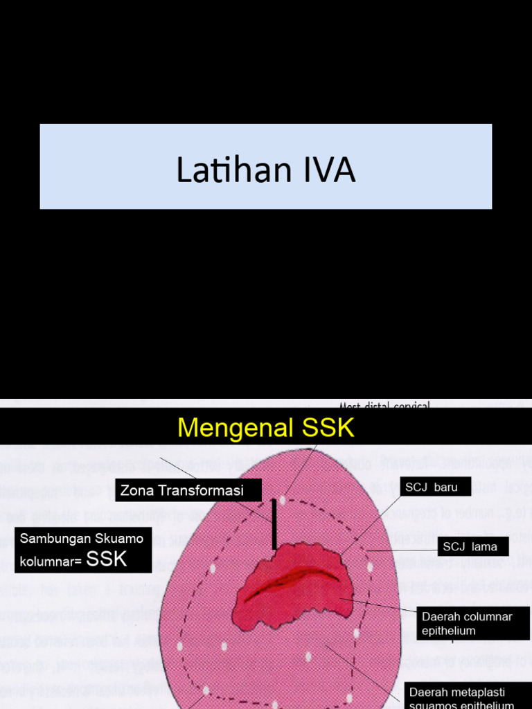 Pembacaan Hasil Iva | PDF