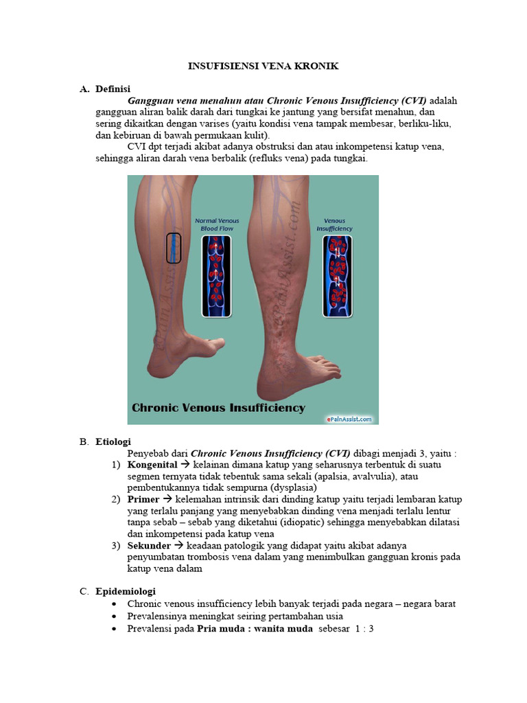 Insufisiensi Vena Kronik | PDF
