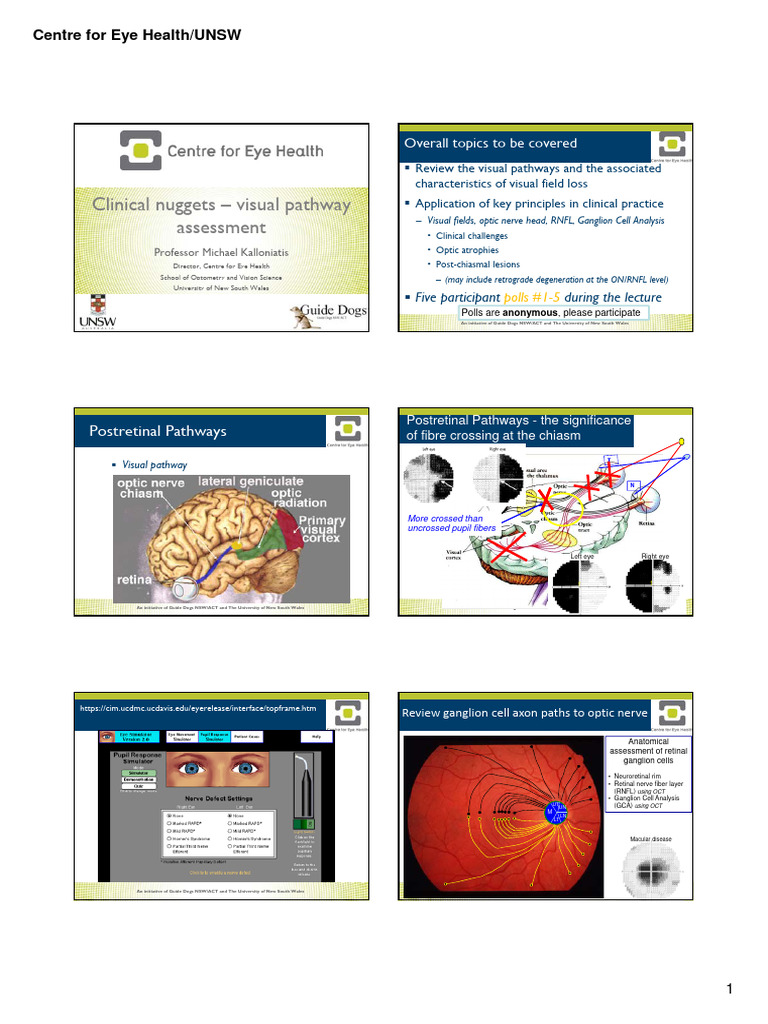 Visual Pathways | PDF | Retina | Visual System
