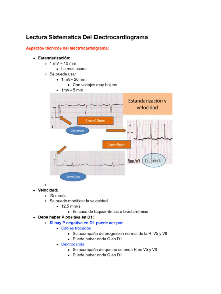 Lectura Sistematica Del EKG | PDF | Electrocardiografia ...