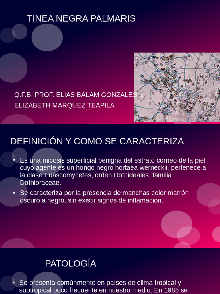 Tinea Negra y Tinea Manuum | PDF | Hongo | Organismos