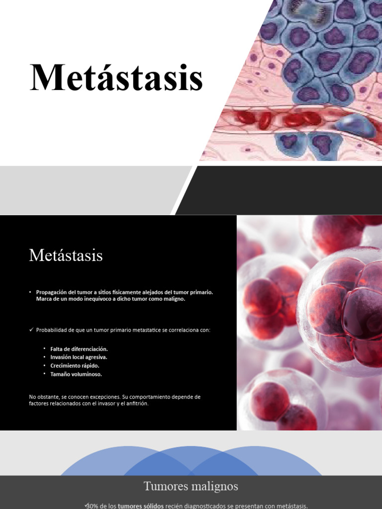 Metástasis: Propagación y Tipos de Tumores | PDF | Metástasis | Cáncer