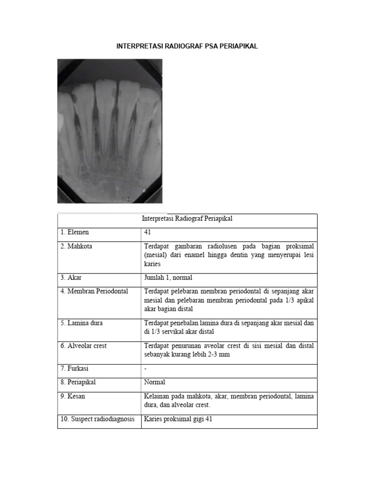 Interpretasi SL RKG PSA Periapikal | PDF