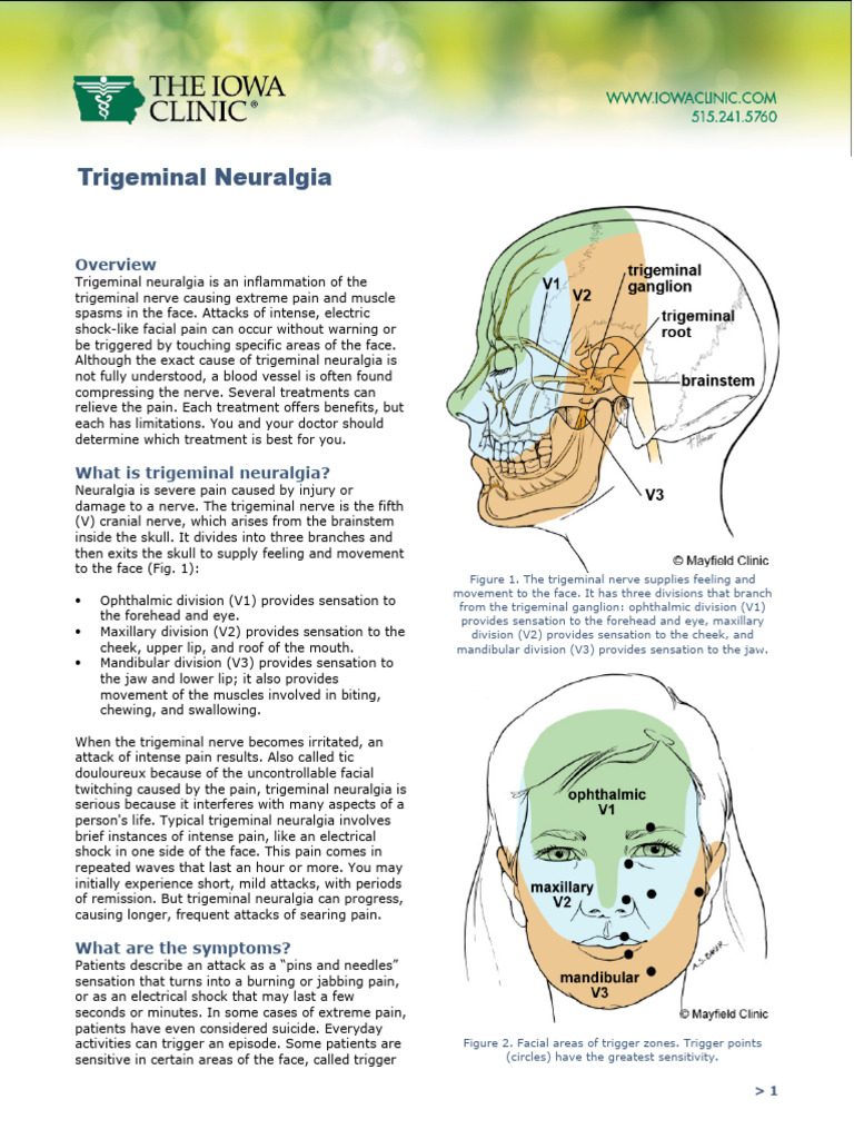 Trigeminal Neuralgia Download Free Pdf Pain Medicine