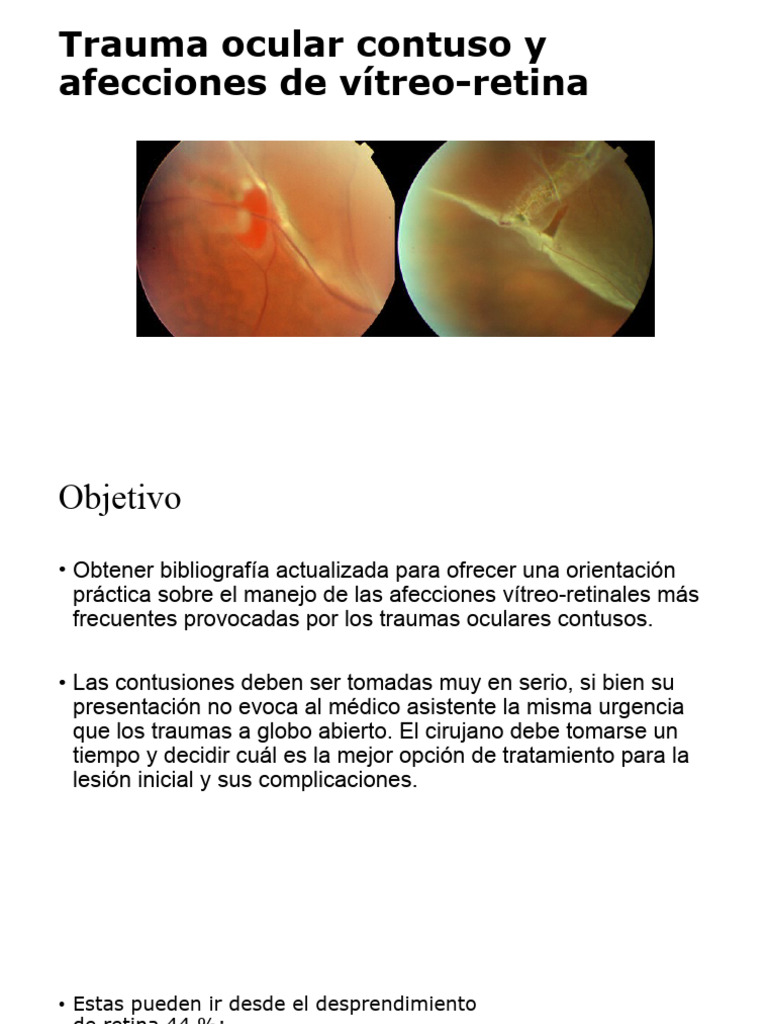 Trauma Ocular Contuso y Afecciones de Vítreo-Retina | PDF | Lesión | Ojo