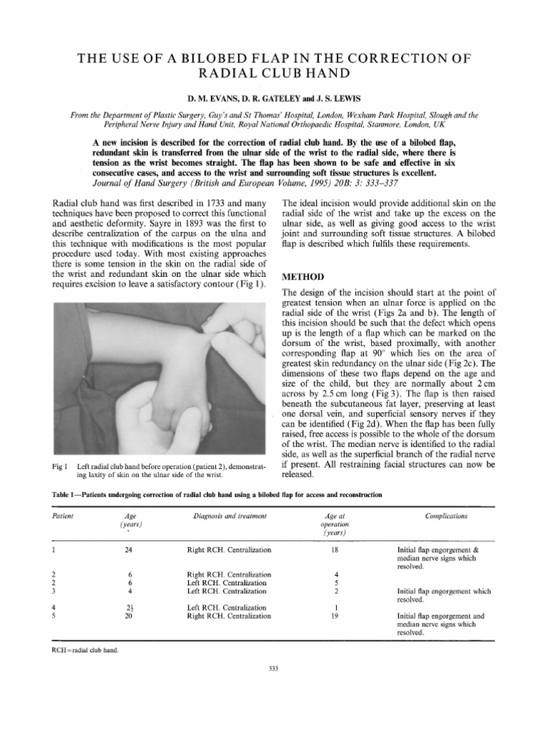 1995 JHS Bilobed Flap Evans | PDF | Hand | Limbs (Anatomy)