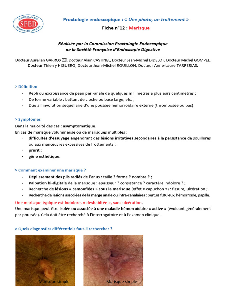 Marisques Pdf Pathologie Hémorroïdaire épidémiologie