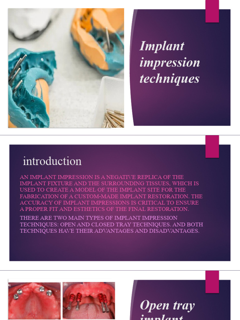 Implant Impression Techniques | PDF | Dental Implant | Medical Specialties
