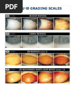 Efron Grading Scales For Contact Lens Co | PDF