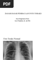 Panduan Lengkap Foto Thorax dan Teknik Pembacaan | PDF