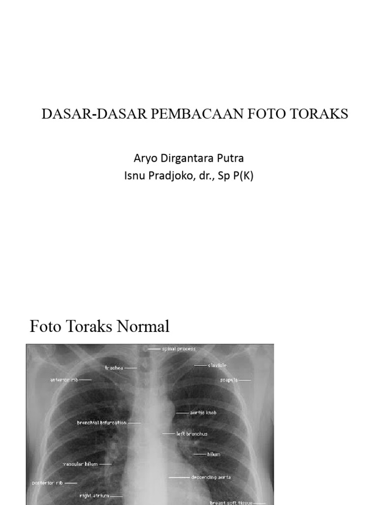 Pembacaan Foto Toraks - 1 | PDF