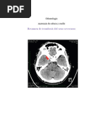 Anatomía del Seno Cavernoso | PDF | Anatomía humana | Cabeza y cuello ...